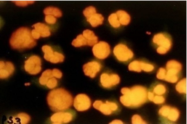 Microscope Slide Stain Kit: Bacterial Spores Test Kit 2 x 100ml